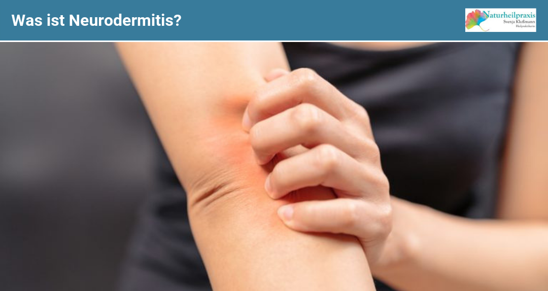 Was ist Neurodermitis? - Svenja Klußmann